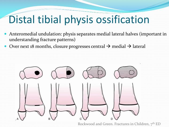 PPT - Pediatric Ankle Fractures PowerPoint Presentation - ID:1973792