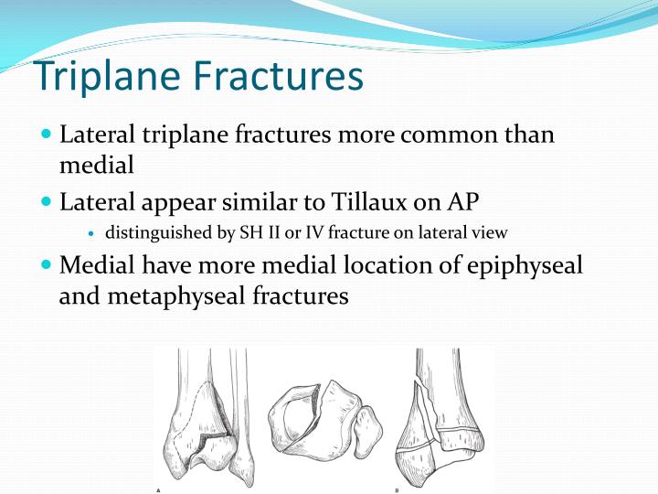 PPT - Pediatric Ankle Fractures PowerPoint Presentation - ID:1973792