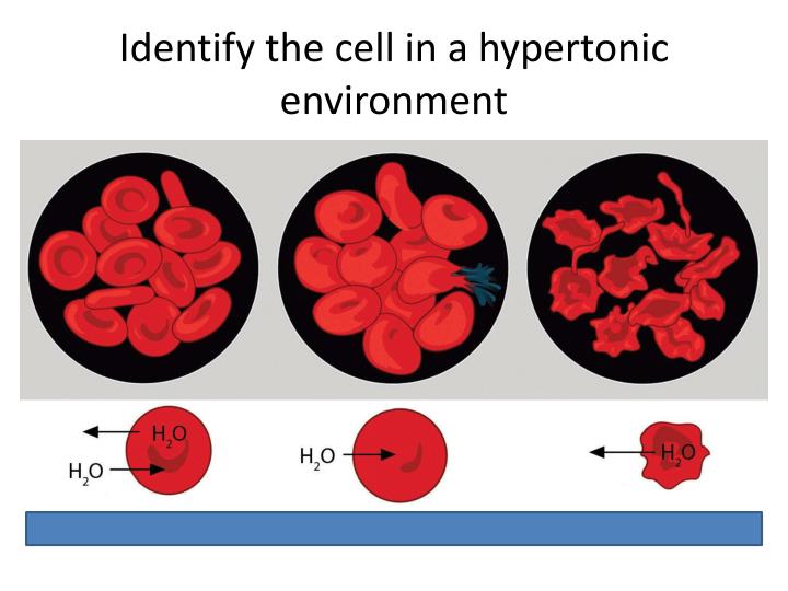 PPT - Hypertonic vs. Hypotonic PowerPoint Presentation - ID:1974033