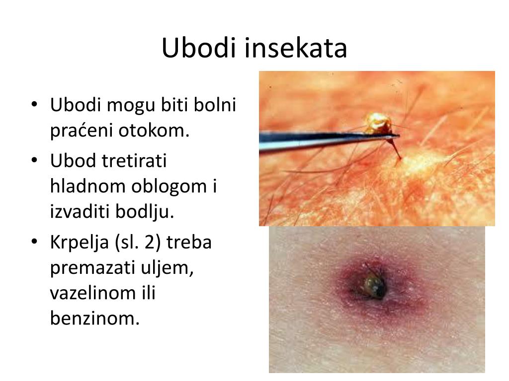 PPT - Zaštita, njega i bolesti organa potpore, kretanja i kože ...