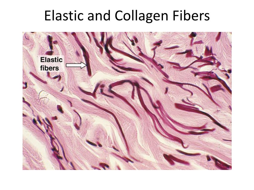 PPT - Connective Tissue PowerPoint Presentation, free download - ID:1974907 PPT - Connective Tissue PowerPoint Presentation, free download - ID:1974907