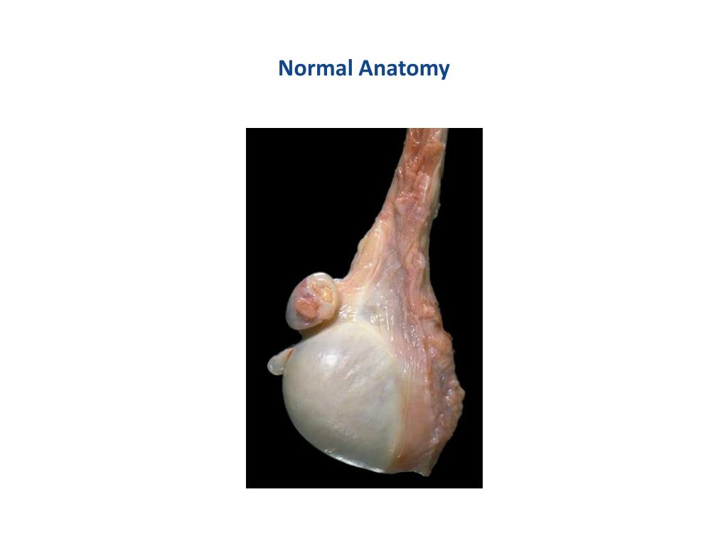 Ppt Testicular Pathology Powerpoint Presentation Free Download Id