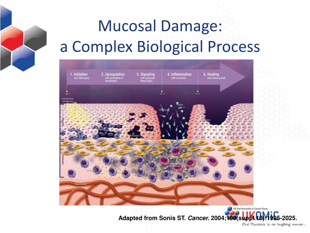 PPT - Managing Mucositis Dr B arry Quinn RN Macmillan Consultant Lead ...