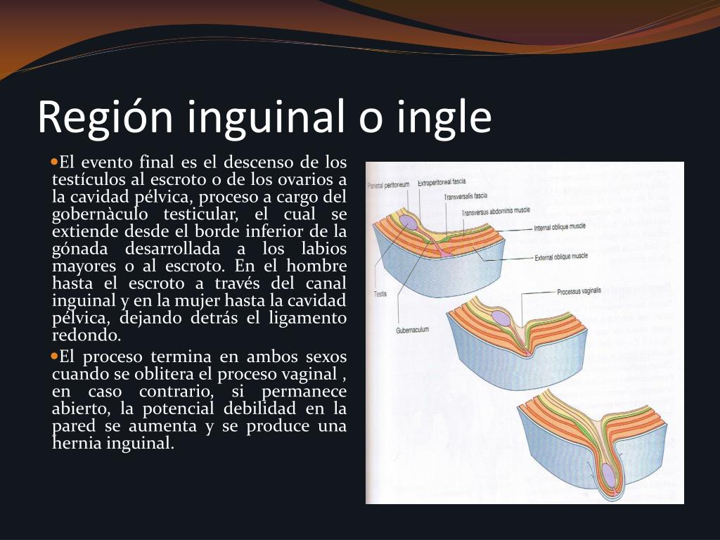 PPT - Tema III Abdomen Subtema 2 Región Inguinal PowerPoint ...