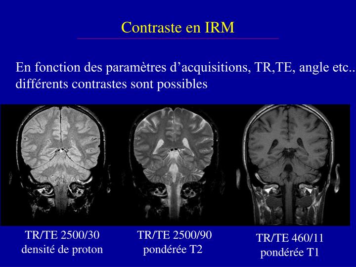 PPT - Base physique IRM Séquences « Echo de Spin » et « Echo de ...