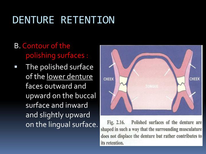 PPT - Dsp 332 principles of complete denture prosthodontics PowerPoint ...