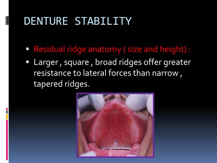 PPT - Dsp 332 principles of complete denture prosthodontics PowerPoint ...