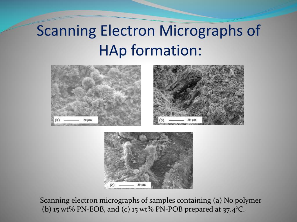 PPT - Utilizing Polyphosphazines in Bone Regeneration Studies ...