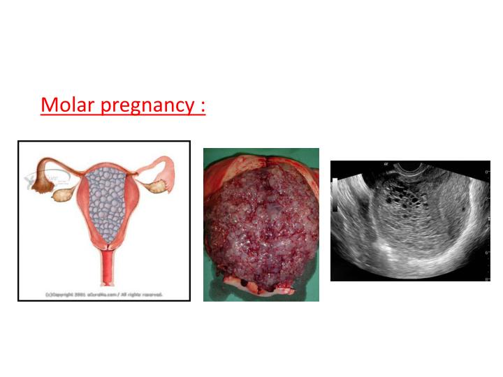 PPT - Obstetric Ultrasound PowerPoint Presentation - ID:1985112
