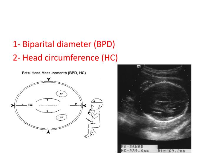 PPT - Obstetric Ultrasound PowerPoint Presentation - ID:1985112