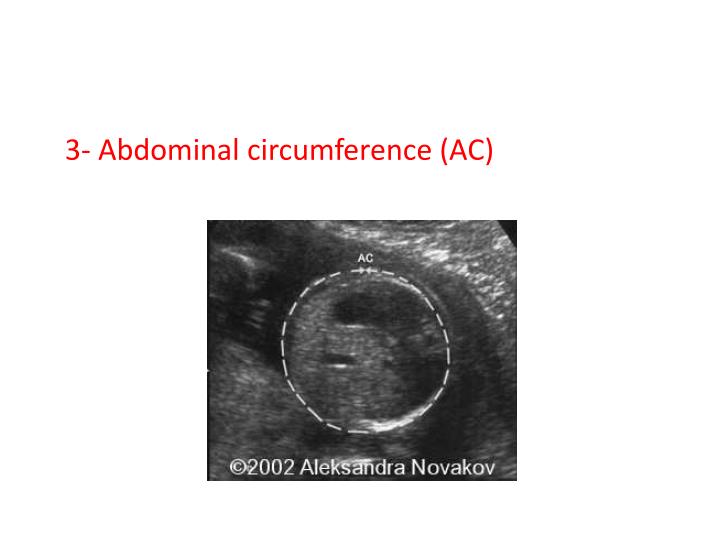 PPT - Obstetric Ultrasound PowerPoint Presentation - ID:1985112