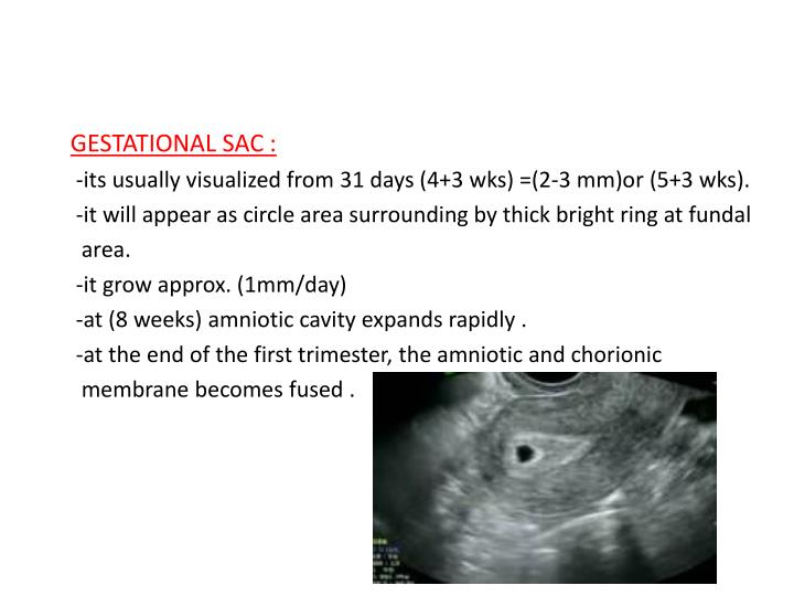 PPT - Obstetric Ultrasound PowerPoint Presentation - ID:1985112
