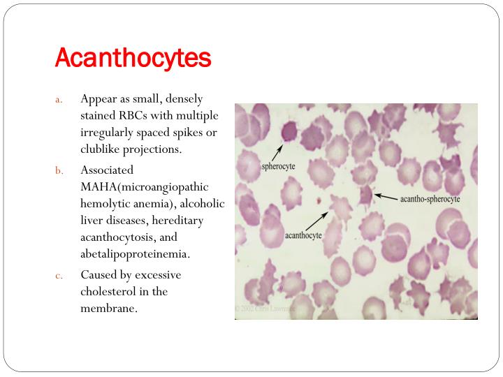 PPT - Erythrocytic Morphology and Associated Diseases(Size and Shape ...