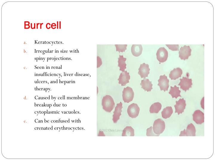 PPT - Erythrocytic Morphology and Associated Diseases(Size and Shape ...