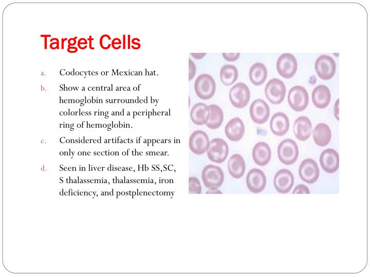 PPT - Erythrocytic Morphology and Associated Diseases(Size and Shape ...