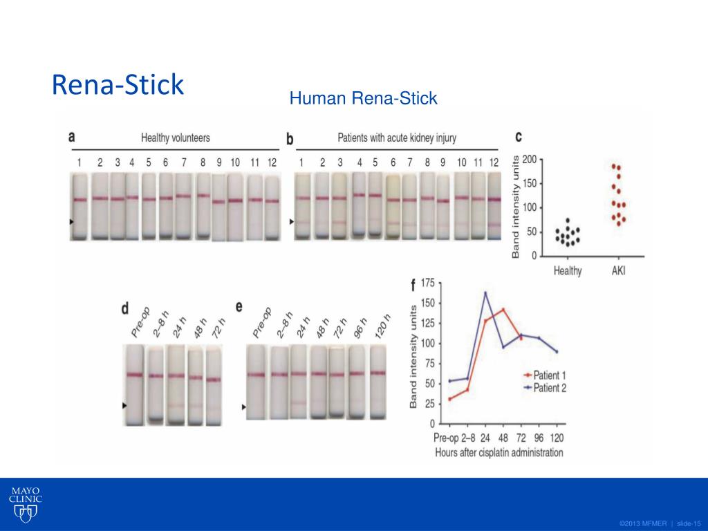 PPT - Biomarkers of AKI: Kidney Troponin PowerPoint Presentation, free ...