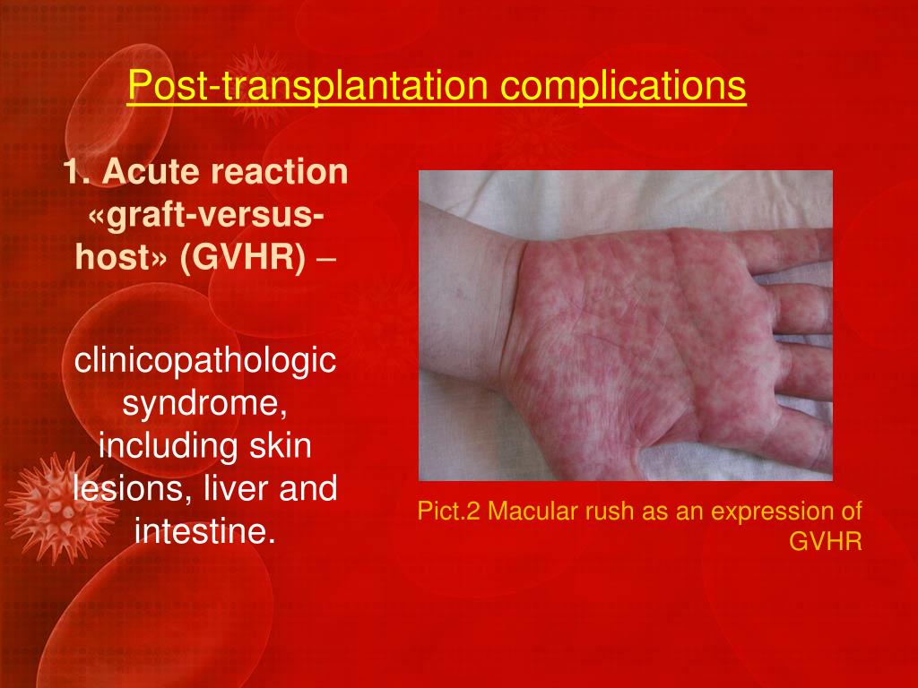 PPT - Transplantation of hematopoietic stem cells in pediatric oncology ...