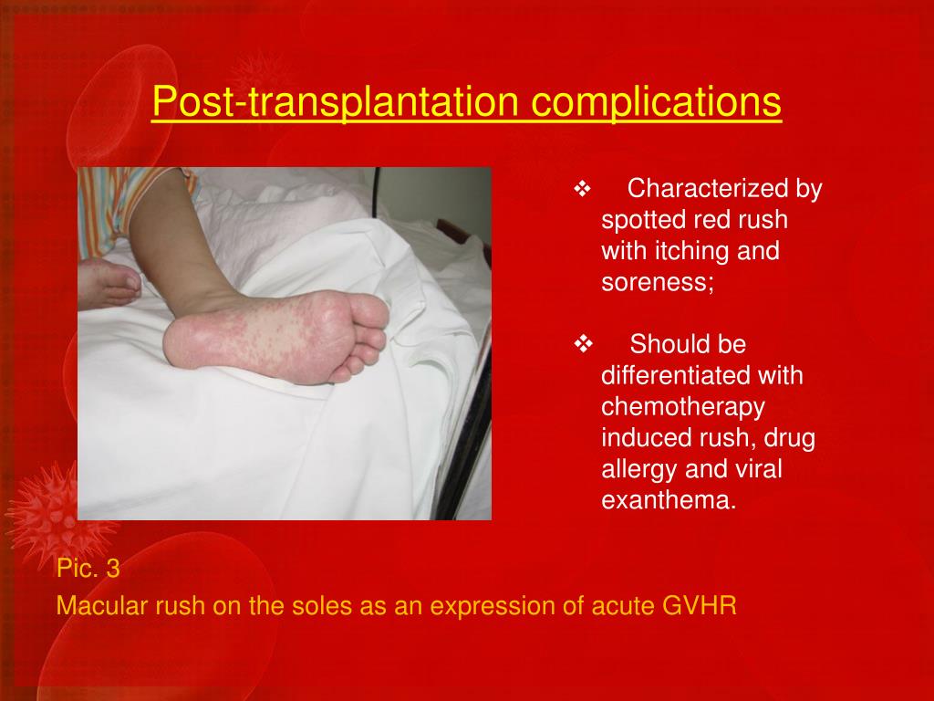 PPT - Transplantation of hematopoietic stem cells in pediatric oncology ...