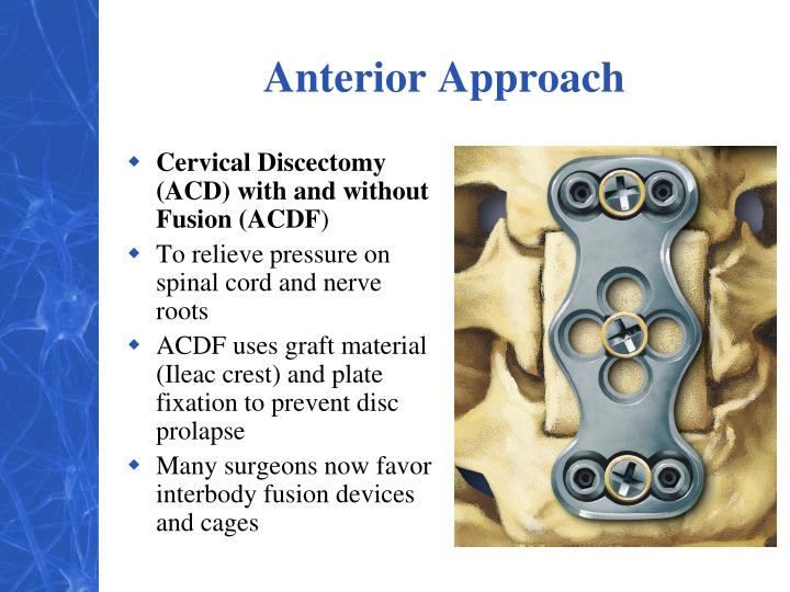 PPT - Cervical Spine Surgery 101 PowerPoint Presentation - ID:1987135