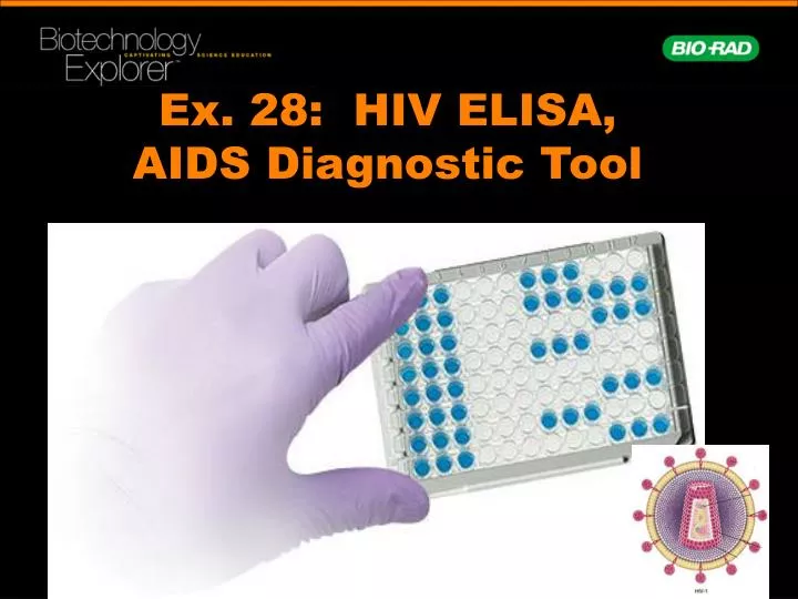 PPT - Ex. 28: HIV ELISA, AIDS Diagnostic Tool PowerPoint Presentation ...