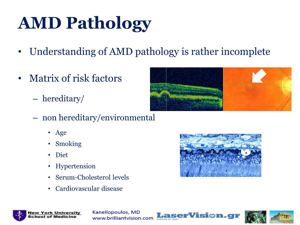 PPT - Safety and Efficacy of Anti-Cholesterol Medication in Soft Drusen ...