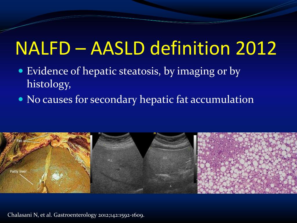 PPT - H EPATITIS VIRAL INFECTION and NON-ALCOHOLIC FATTY LIVER DISEASE ...