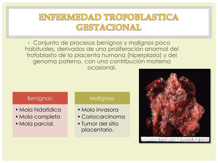 PPT - ENFERMEDAD TROFOBLASTICA GESTACIONAL PowerPoint Presentation - ID ...