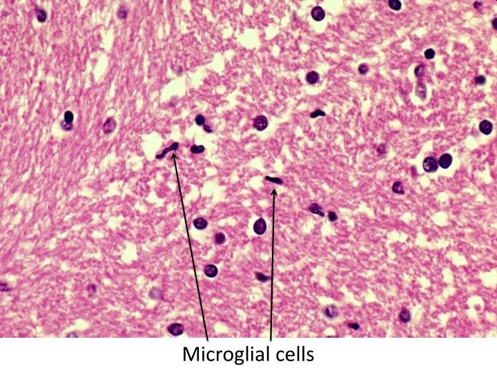 PPT - Nervous System Pathology PowerPoint Presentation - ID:1994906