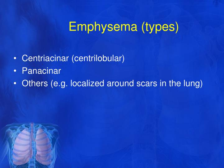 PPT - The Respiratory System PowerPoint Presentation - ID:1995261