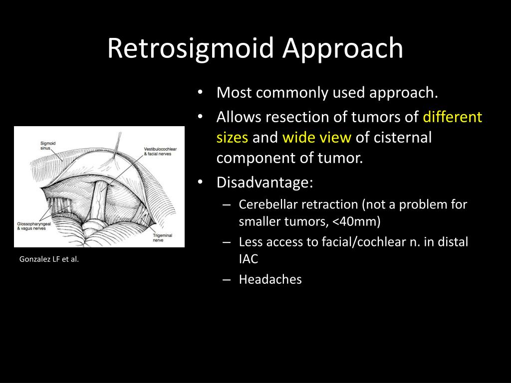 PPT - Vestibular Schwannoma Surgical management and outcomes PowerPoint ...