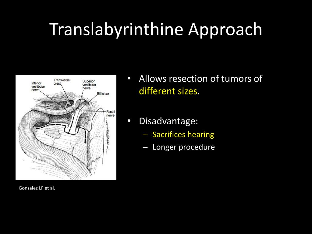 PPT - Vestibular Schwannoma Surgical management and outcomes PowerPoint ...