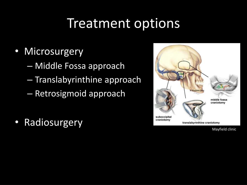 PPT - Vestibular Schwannoma Surgical management and outcomes PowerPoint ...