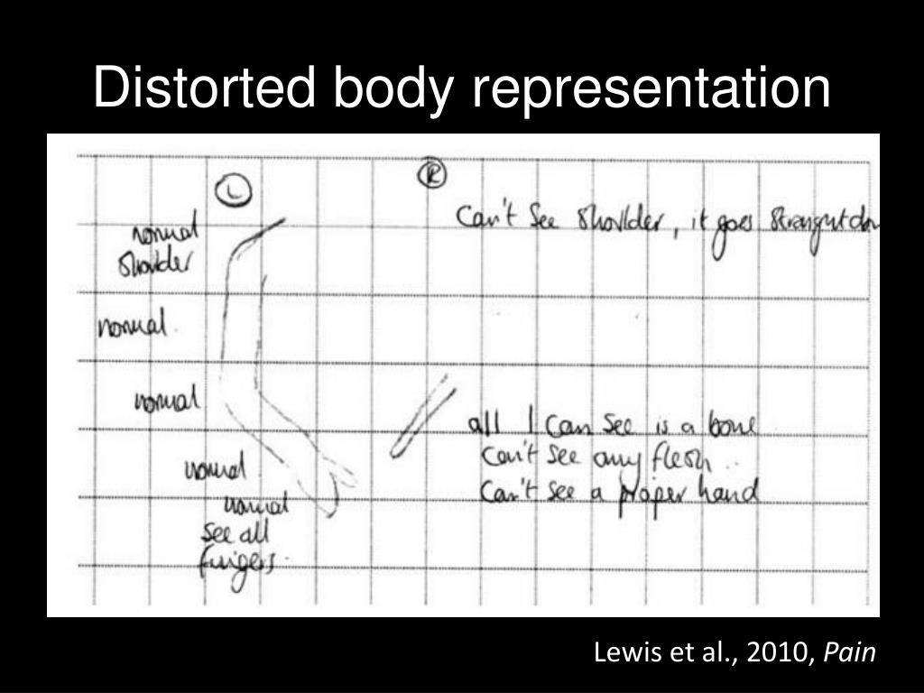 PPT - The Brain in Pain Cortical contributions to Complex Regional Pain ...