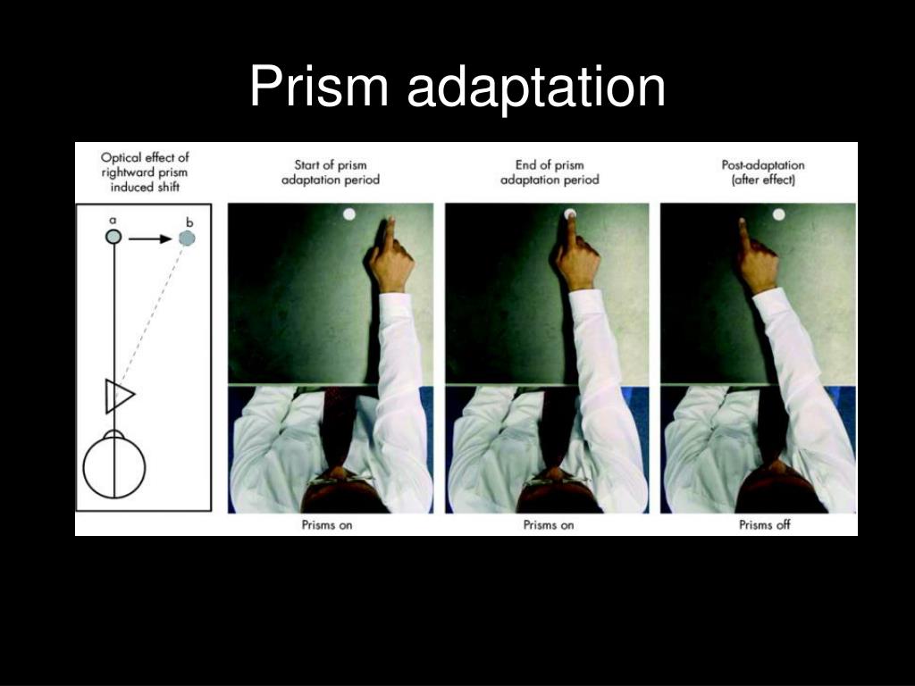 PPT - The Brain in Pain Cortical contributions to Complex Regional Pain ...