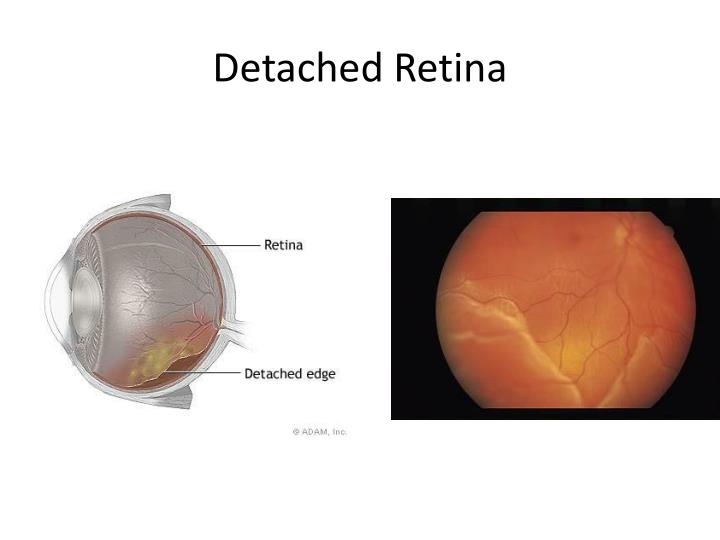 PPT - The Senses PowerPoint Presentation - ID:1996883