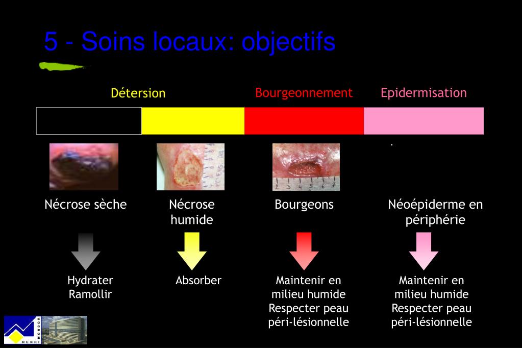 PPT - PRISE EN CHARGE DES PLAIES DU PIED DIABÉTIQUE PowerPoint ...