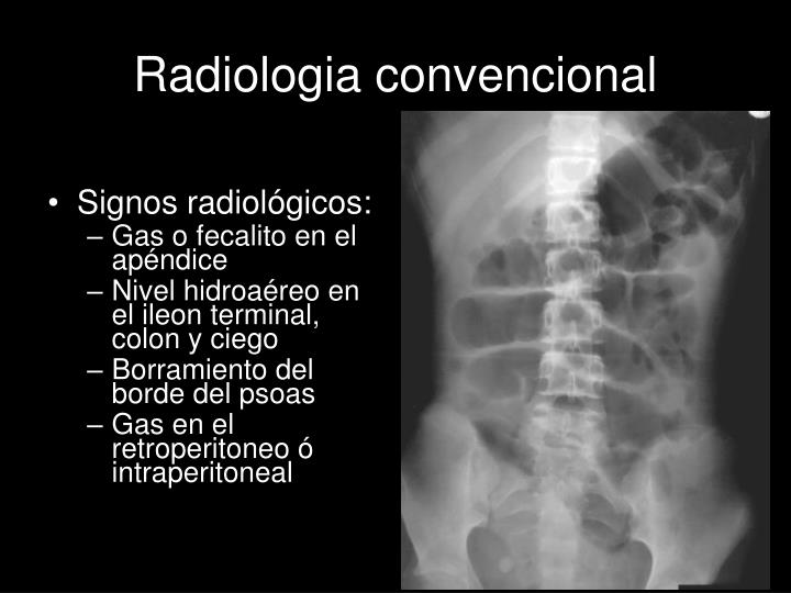PPT - APENDICITIS AGUDA PowerPoint Presentation - ID:1997466