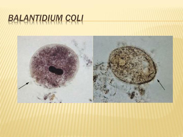 PPT - Balantidium coli PowerPoint Presentation - ID:1997511