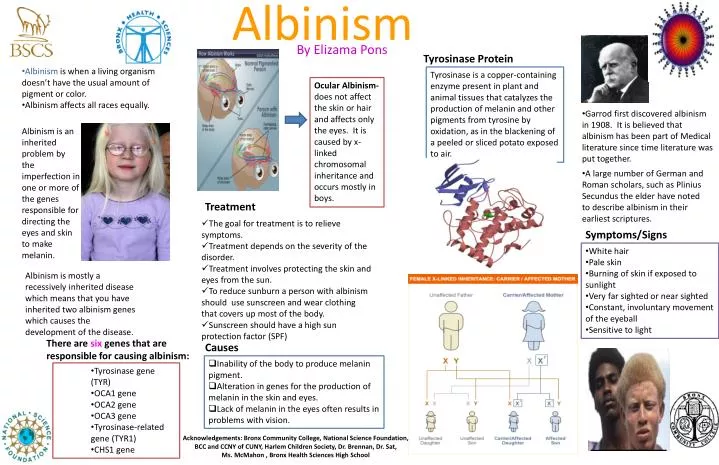 PPT - Albinism is when a living organism doesn’t have the usual amount of pigment or color ...