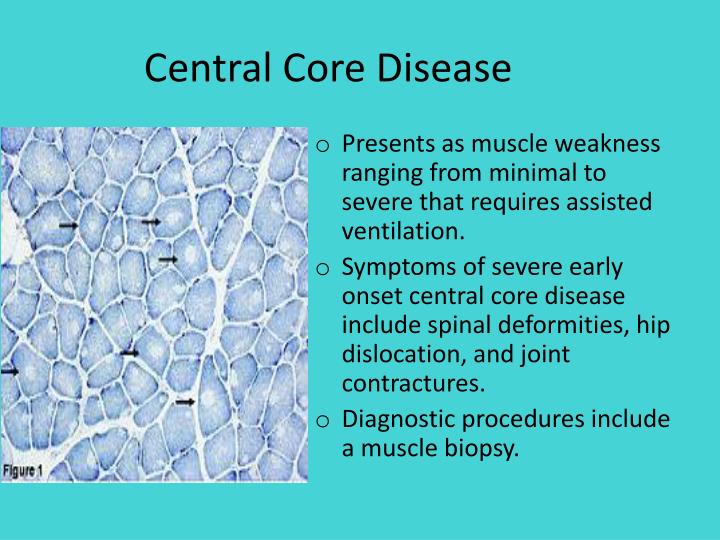 PPT - The Muscular System PowerPoint Presentation - ID:1999919