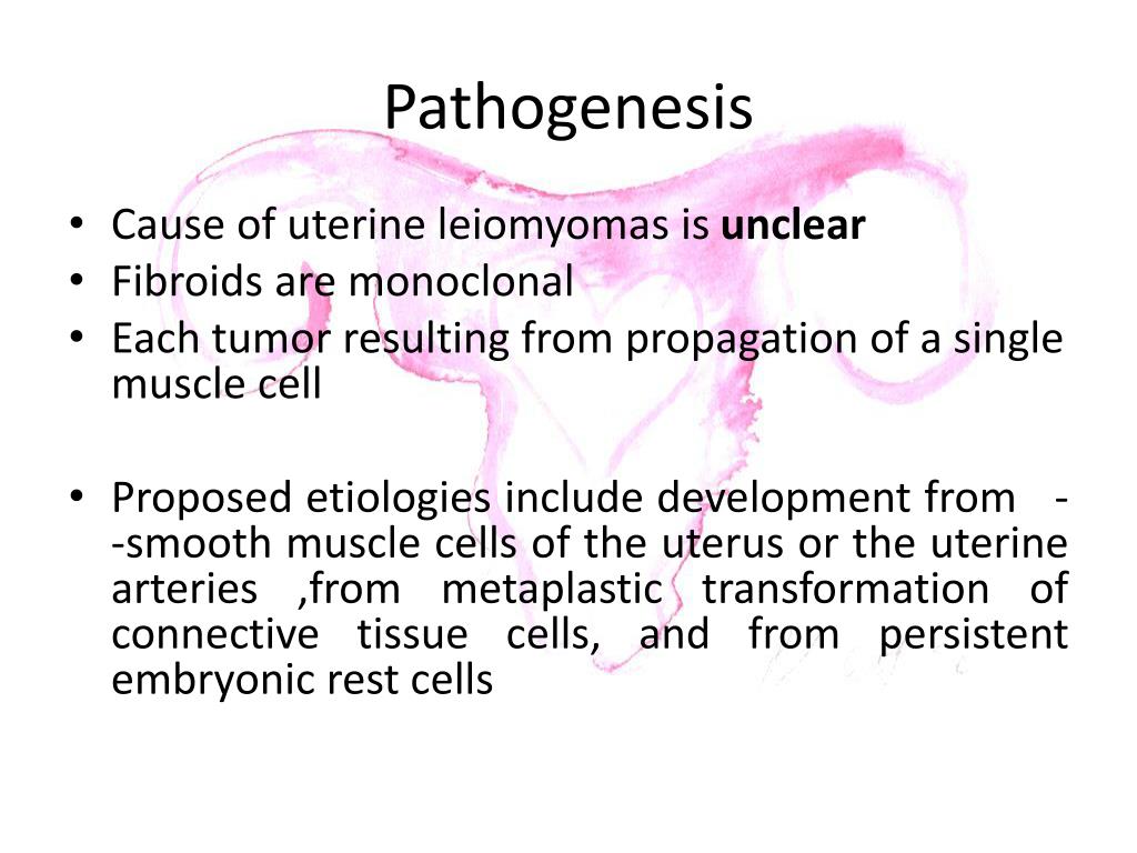 PPT - Myoma Uteri OB-GYN Rotation Quirino Memorial Medical Center ...