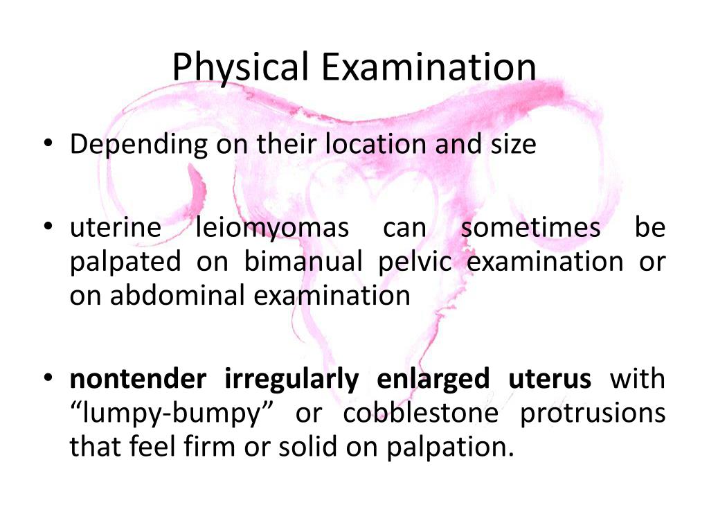 PPT - Myoma Uteri OB-GYN Rotation Quirino Memorial Medical Center ...