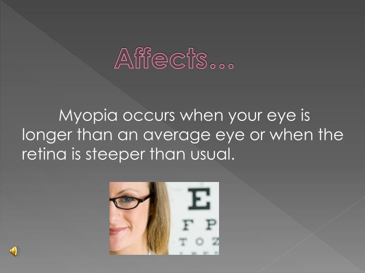 PPT - Myopia PowerPoint Presentation - ID:2000043