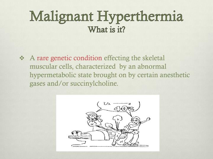 PPT - Malignant Hyperthermia Keeping Our Patients Safe PowerPoint ...