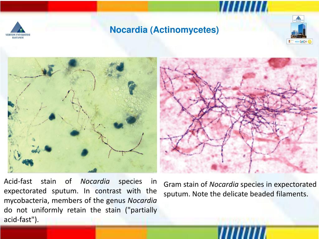 PPT - Nocardia (Aerobic Actinomycetes) PowerPoint Presentation, free ...