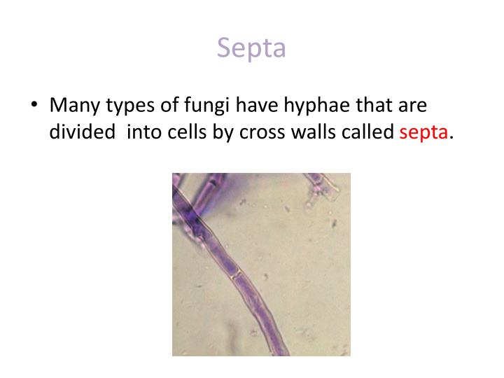 PPT - Section 5.3 : Kingdom Fungi pgs. 152-158 PowerPoint Presentation ...