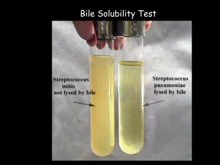 PPT - Streptococci PowerPoint Presentation - ID:2005468