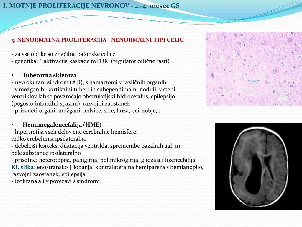 PPT - MOTNJE RAZVOJA ŽIVČEVJA Nataša Šuštar, dr.med. PowerPoint ...