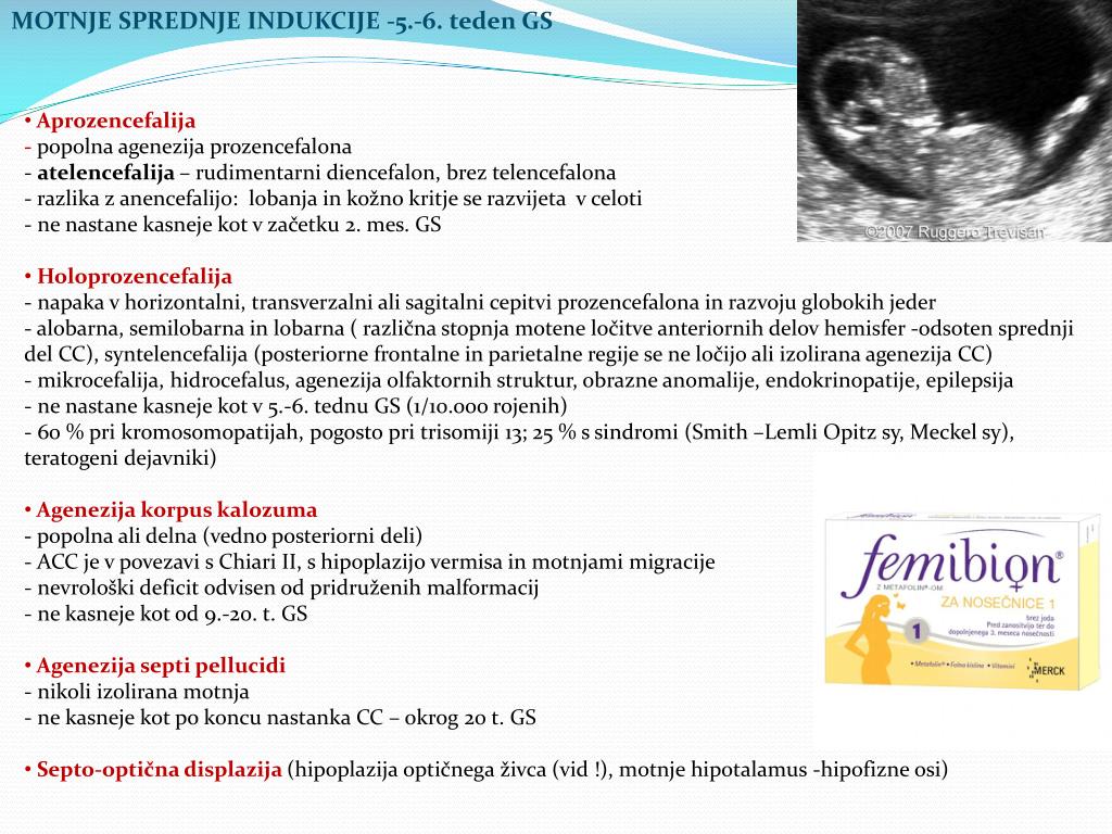 PPT - MOTNJE RAZVOJA ŽIVČEVJA Nataša Šuštar, dr.med. PowerPoint ...