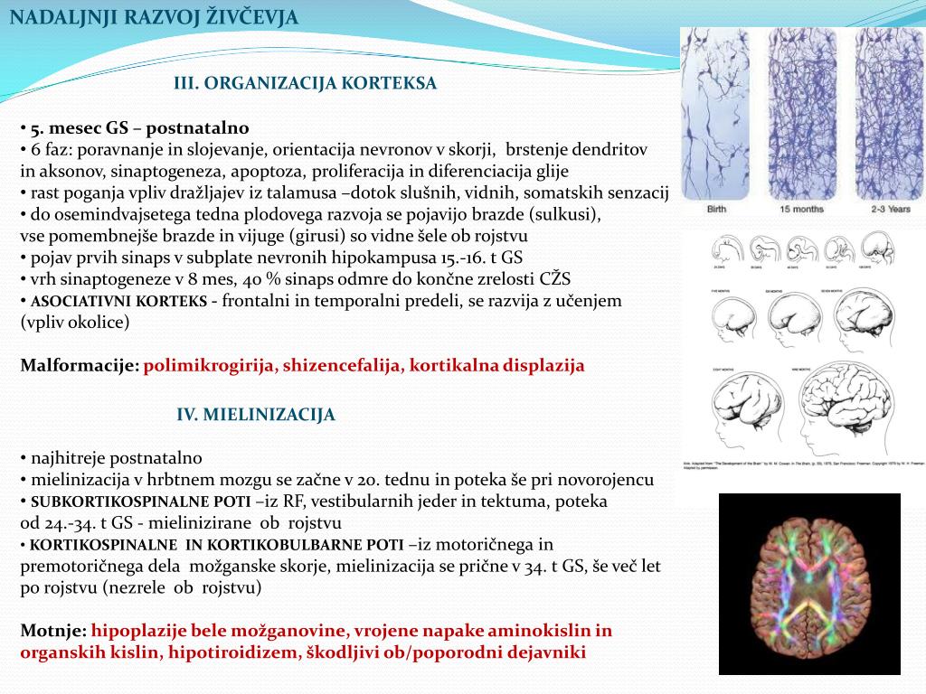 PPT - MOTNJE RAZVOJA ŽIVČEVJA Nataša Šuštar, dr.med. PowerPoint ...